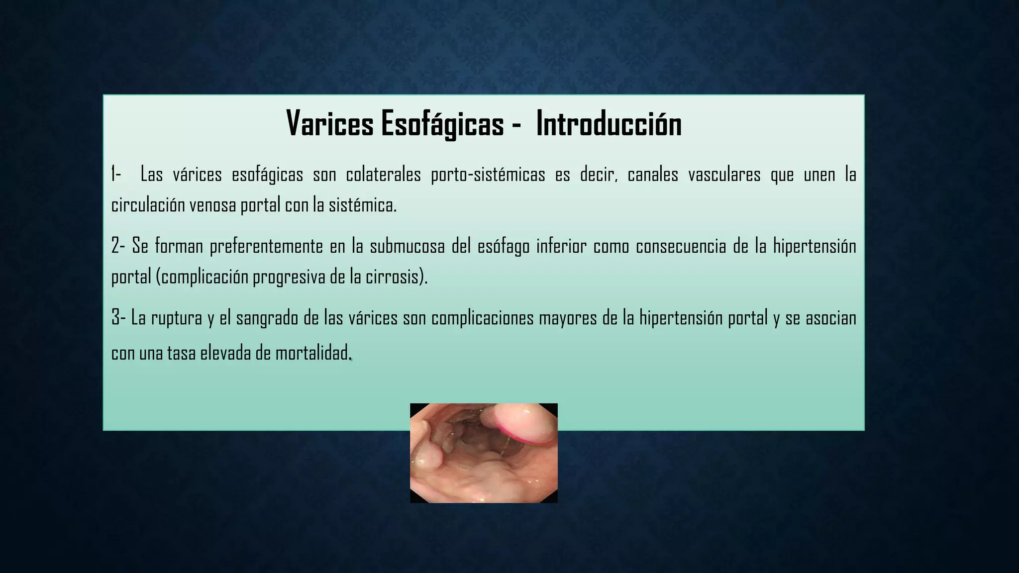 Varices esofágicas | PDF