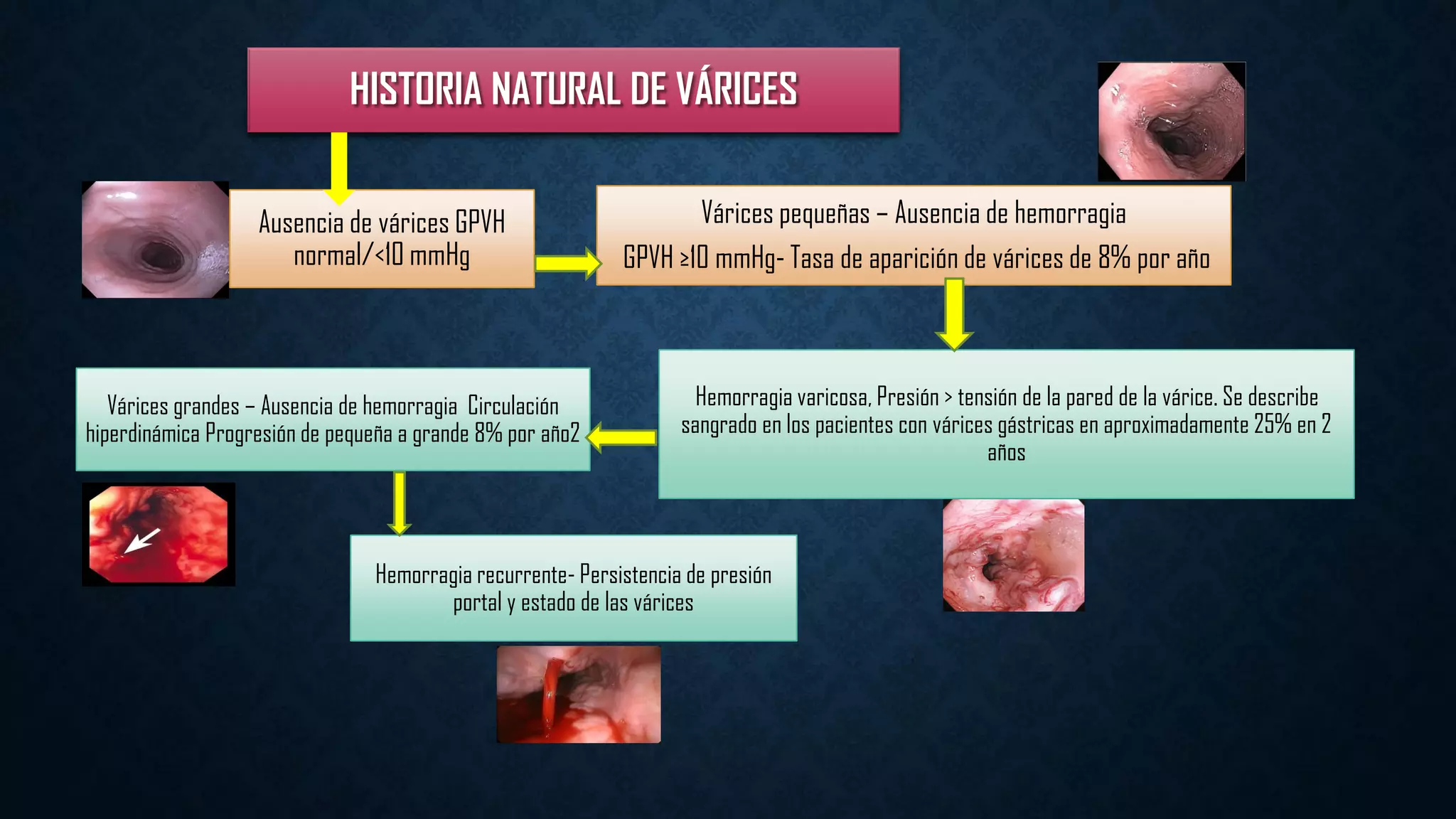 Varices esofágicas | PDF