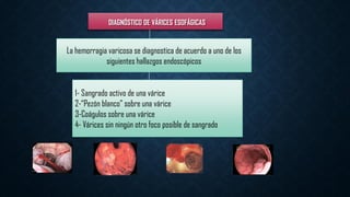 Varices esofágicas | PDF