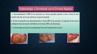 Varices esofágicas | PDF