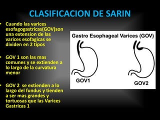 Varices gastricas. miguel chavez rossell | PDF