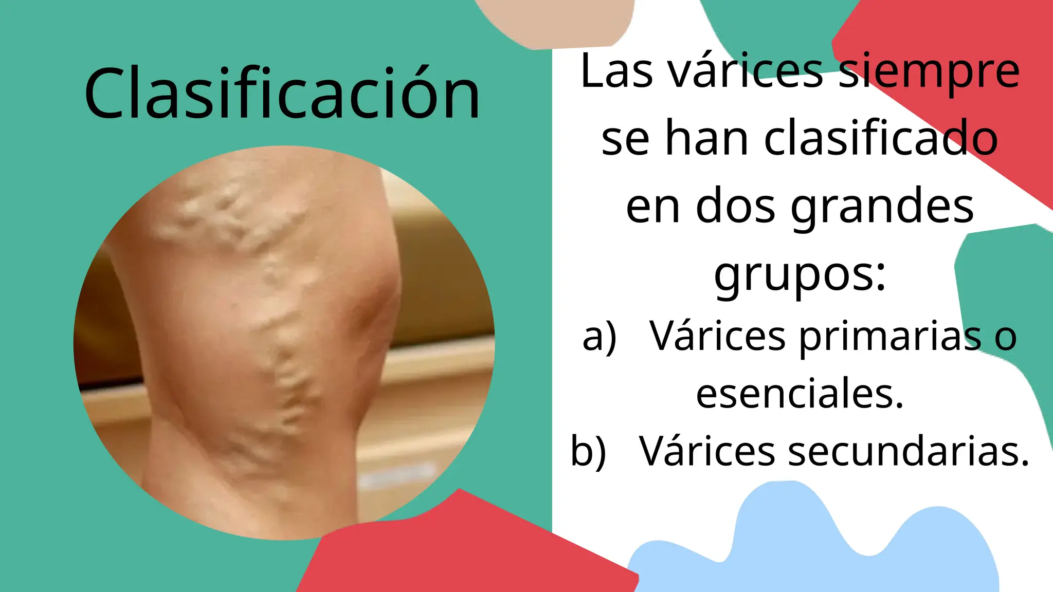 Varices en miembros inferiores, complicaciones | PPT