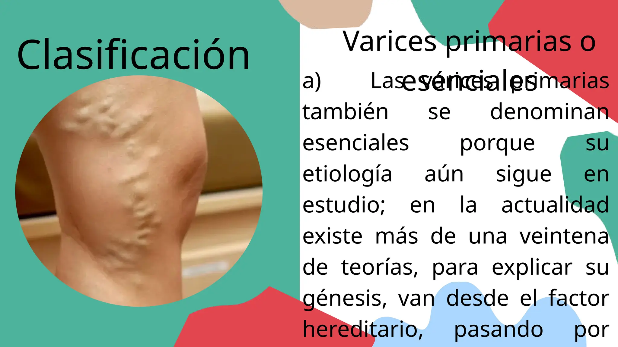 Varices en miembros inferiores, complicaciones | PPT