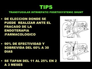 Várices Esofágicas sangrantes | PPT