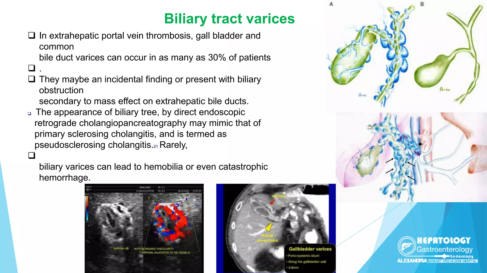Varices Types and sites.pptx