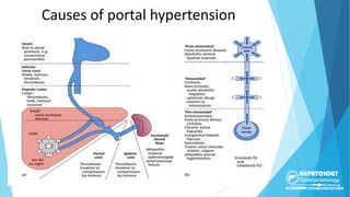 Varices Types and sites.pptx