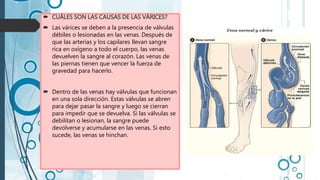 Varices y hemorroides-Definicion-Causas-tratamiento | PPTX