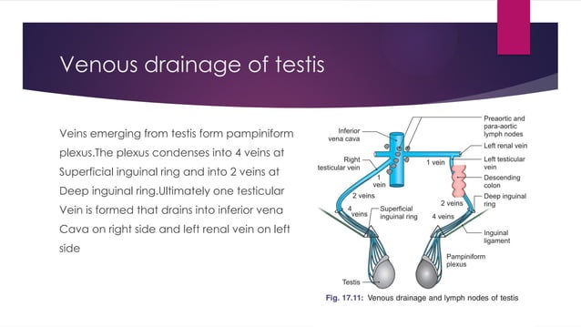 Varicocele presentation ppt akdjfjfjskacnnxnznxnc | PPT