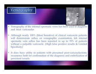 Varicocele | PDF
