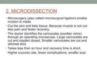 Comprehensive Overview of Varicocele: Anatomy, Diagnosis, and Treatment ...