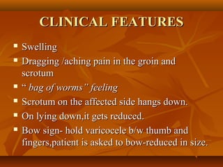 Varicocele | PPT