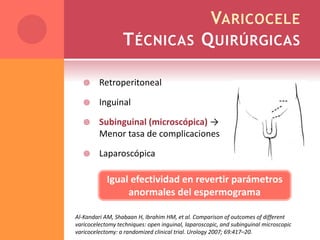 Varicocele | PPTX