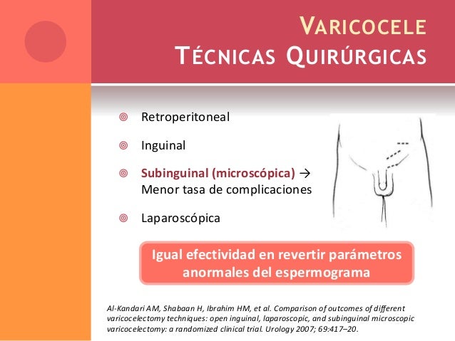 Varicocele