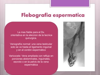 varicocele-160309231054.pdf