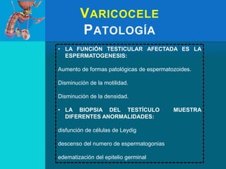 Varicocele | PPTX