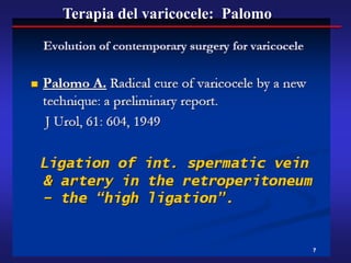 Varicocele | PDF