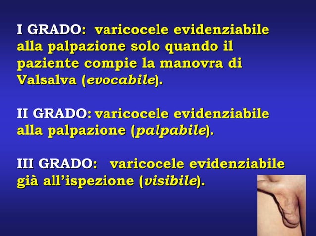 Varicocele | PPT