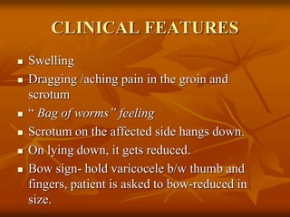 Varicocele | PPT