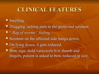 varicocele-200430092536 (1)hghsbsbsnb.ppt
