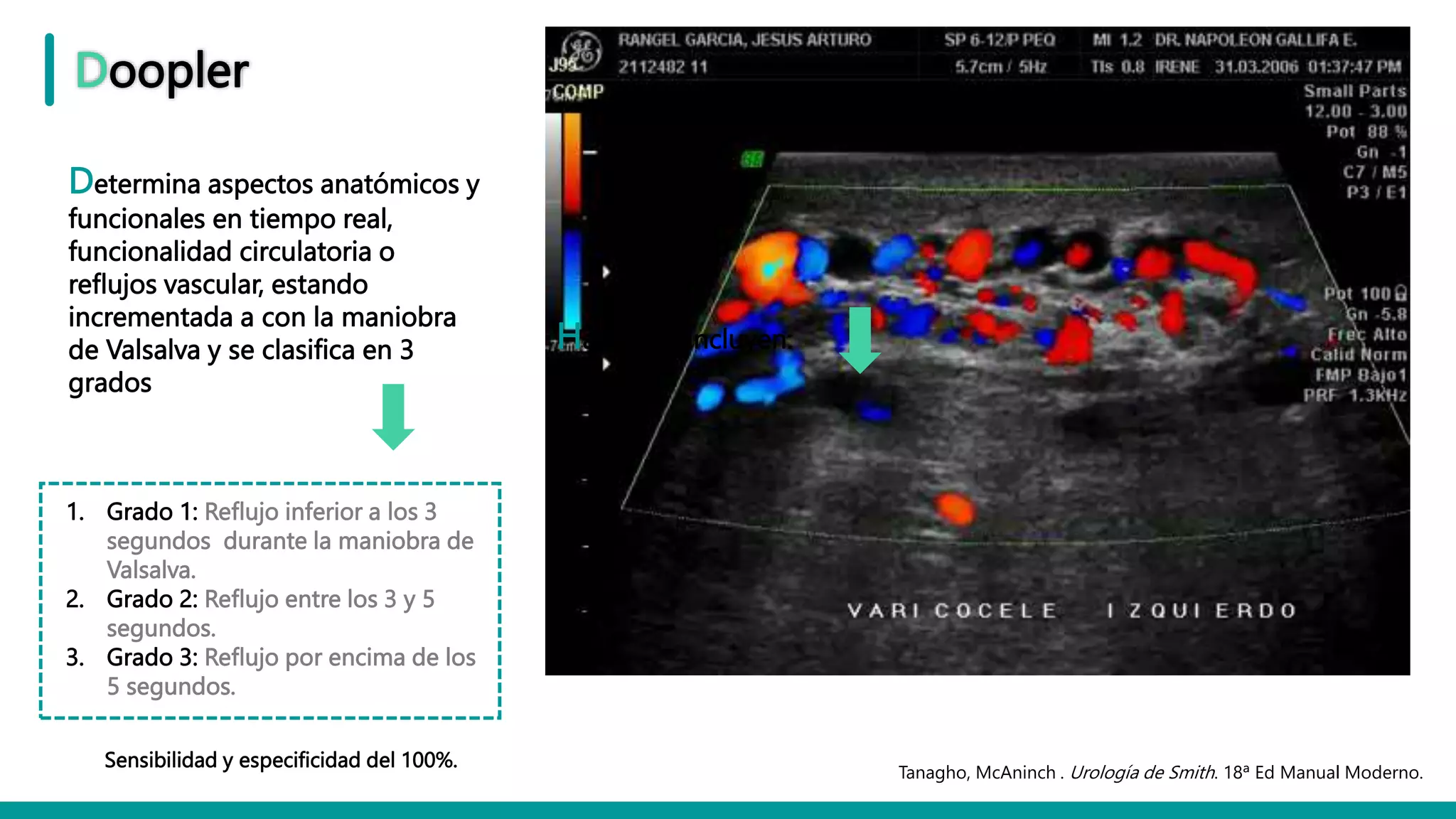 Varicocele.pptx