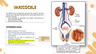 varicocele-practica urología para internos de pregrado | PPTX