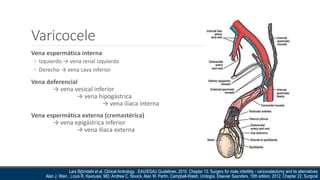 Varicocele y varicocelectomía tratamiento quirúrgico | PPTX