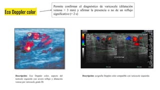 VARICOCELE_GRUPO 1.pptx