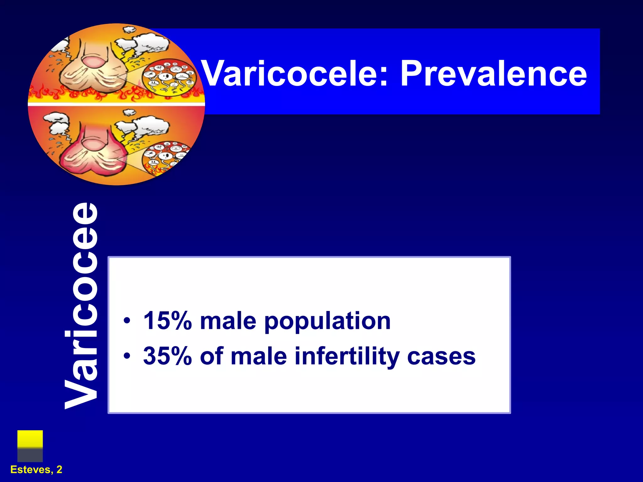 Varicocele in the ICIS Era | PDF