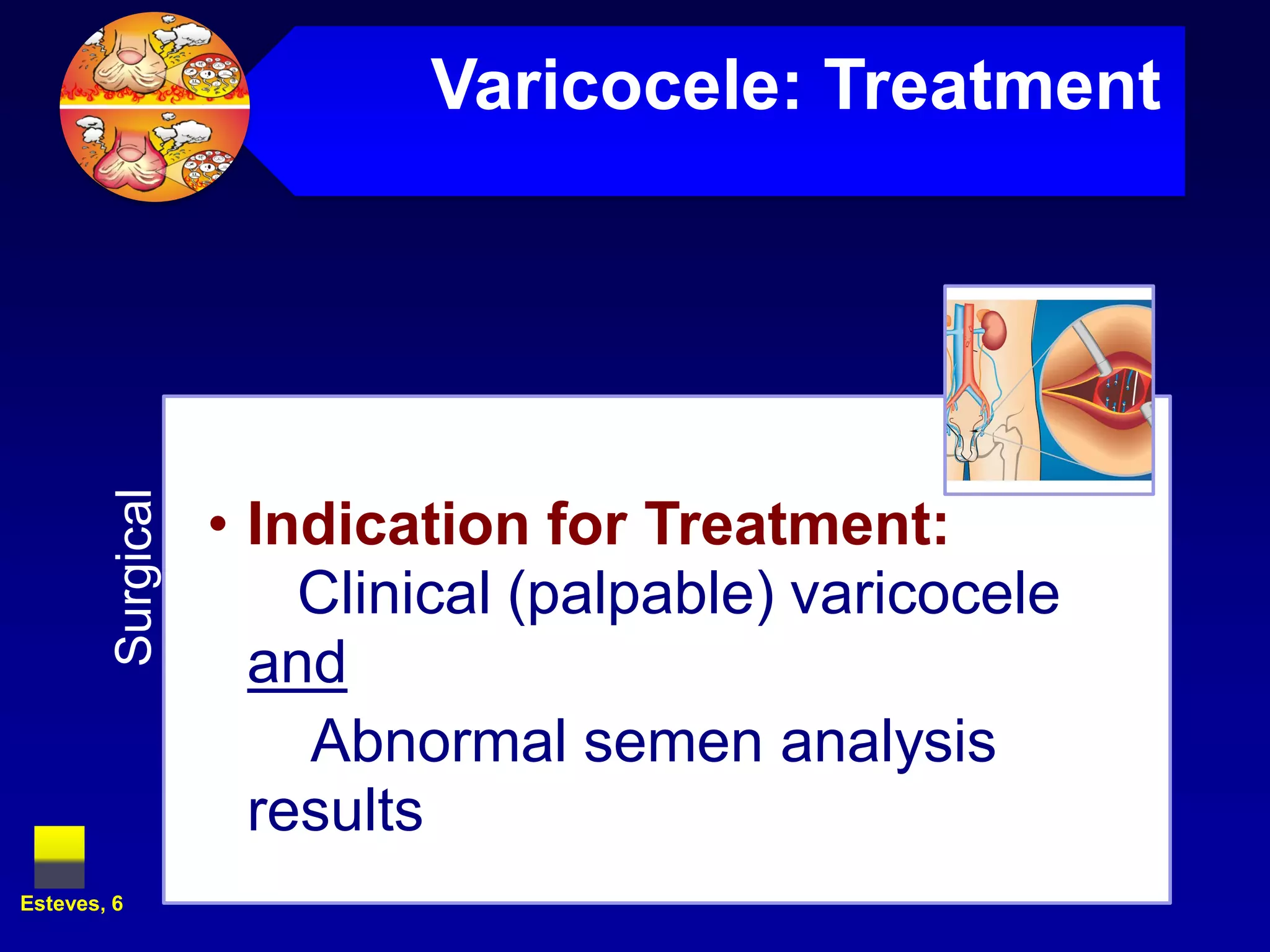 Varicocele in the ICIS Era | PDF