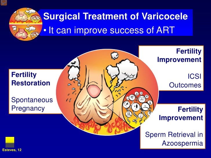 Varicocele In The Icis Era
