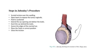 Comprehensive Overview of Scrotal Conditions: Hydrocele, Hematocele ...