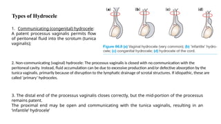 Comprehensive Overview of Scrotal Conditions: Hydrocele, Hematocele ...