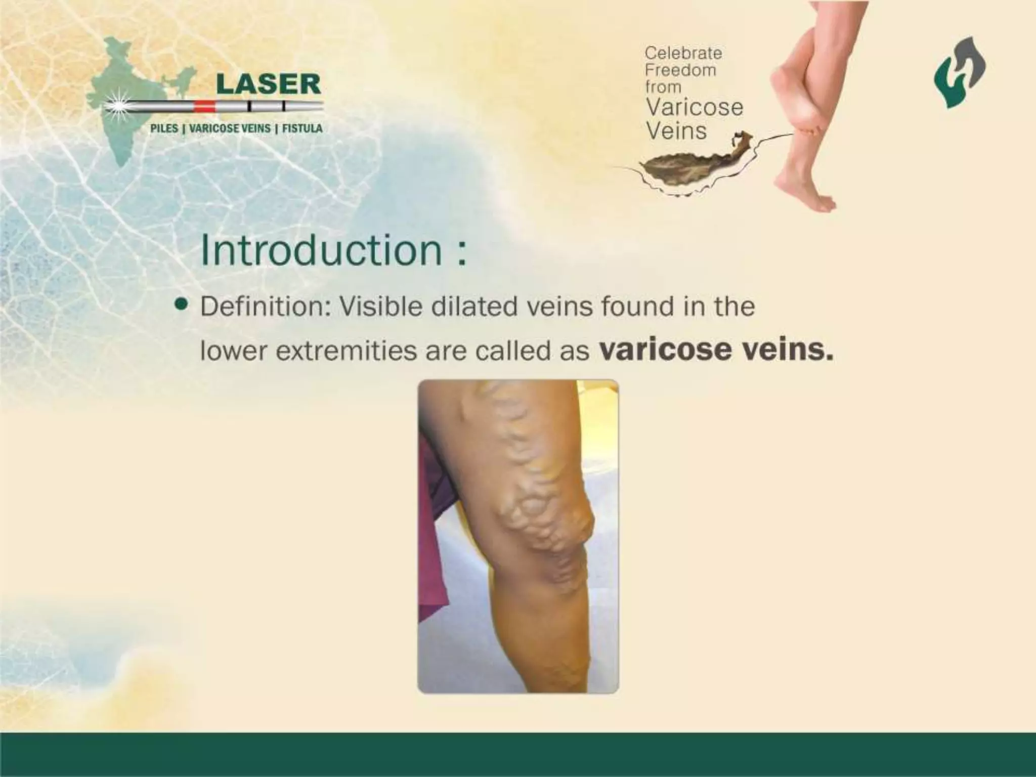 Varicose Veins | All About Varicose Veins | Varicose Veins Treatment | PPTX