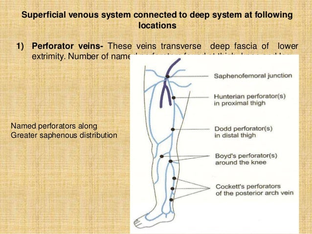 Varicose vein