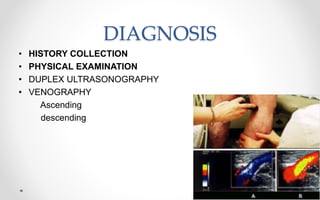 Varicose vein | PPTX