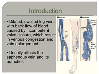 Varicose vein | PPTX