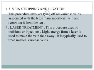 Varicose vein | PPT