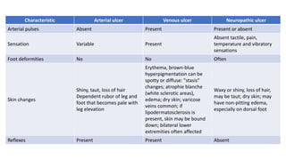 Varicose vein | PPTX