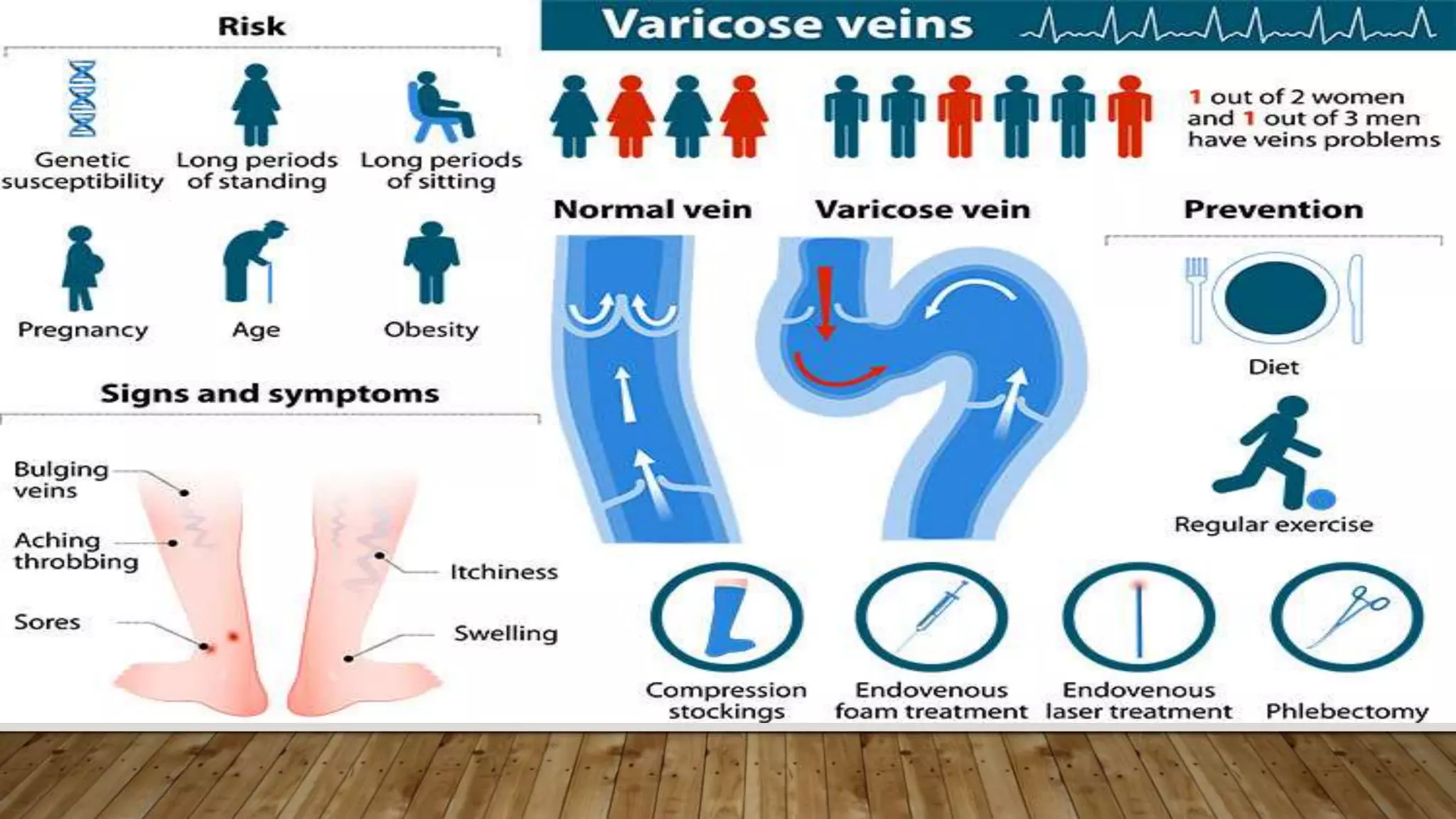 Varicose vein.pdf