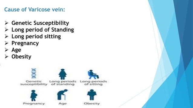 Varicose vein.pptx