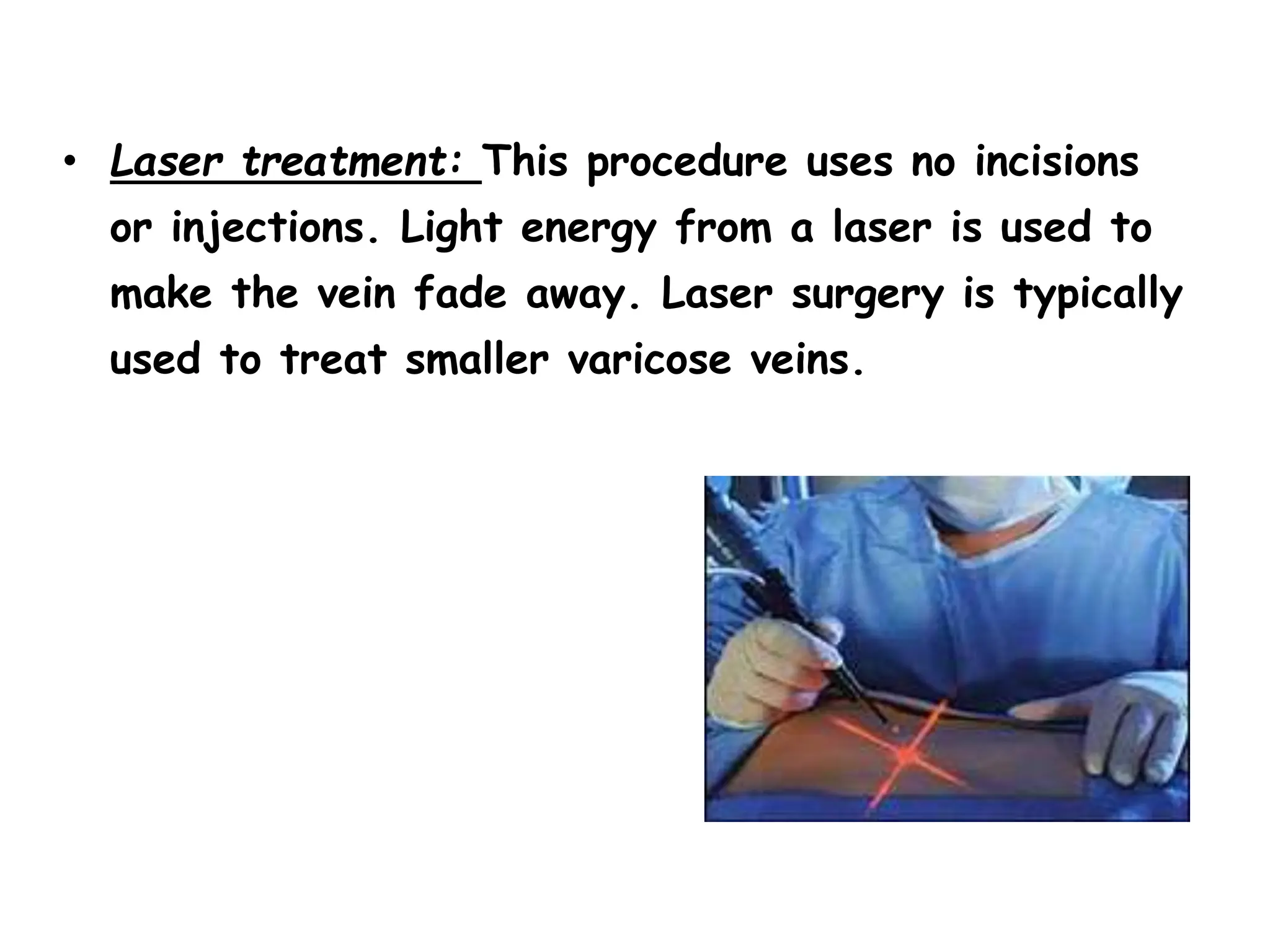 VARICOSE VEIN.ppt