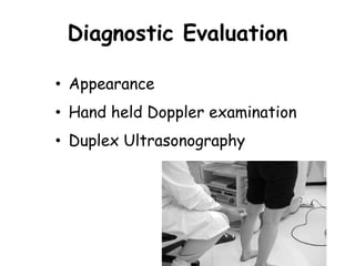 VARICOSE VEIN.ppt
