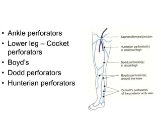 VARICOSE VEIN.ppt
