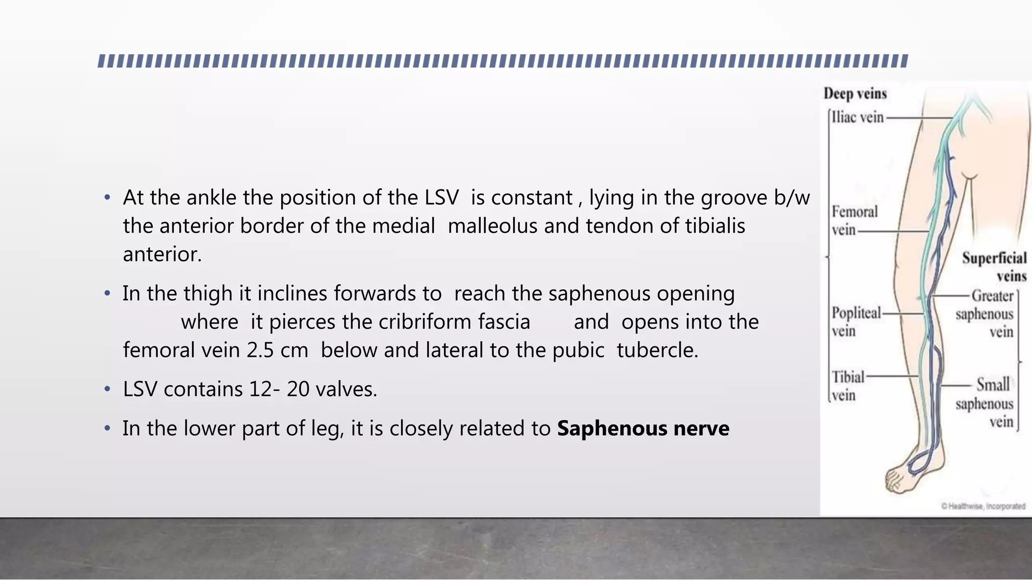 Varicose vein- Kavo.pptx