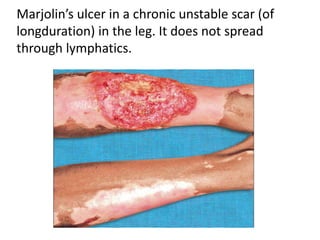 Varicose Vein and Venous Ulcer - Prof. Ri.pptx