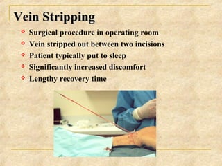 Varicose vein patient_talk | PPT