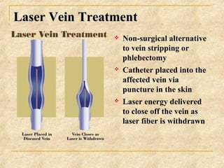 Varicose vein patient_talk | PPT