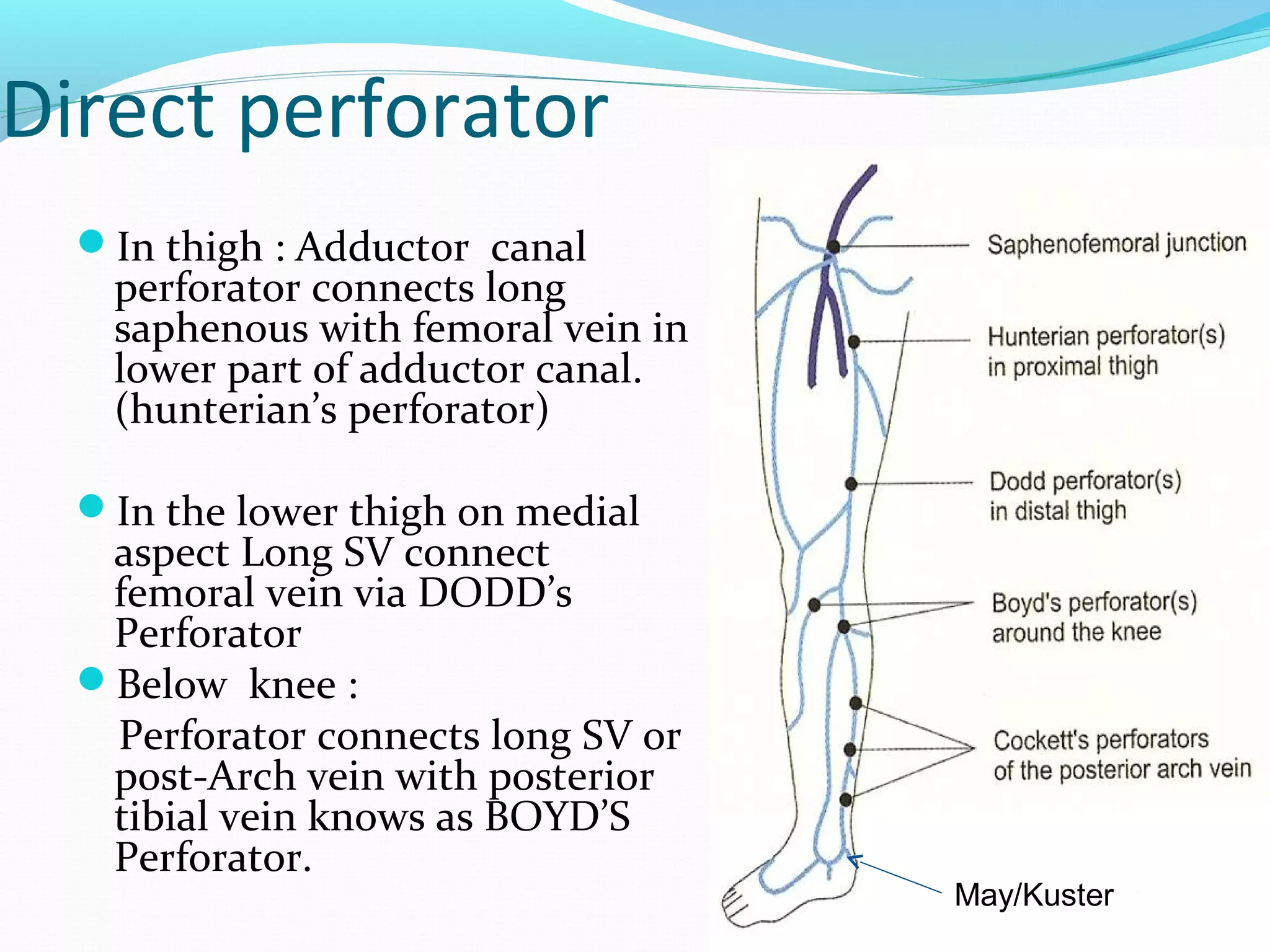 Varicose vein ppt (thu) | PPT