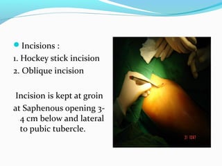 Varicose vein ppt (thu) | PPT