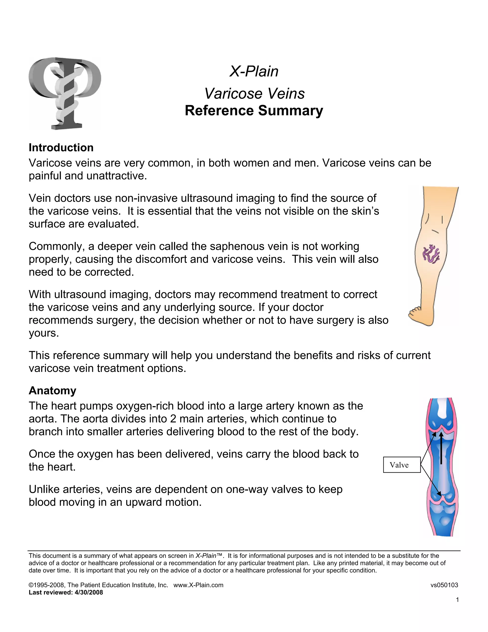 Varicose Veins | PDF